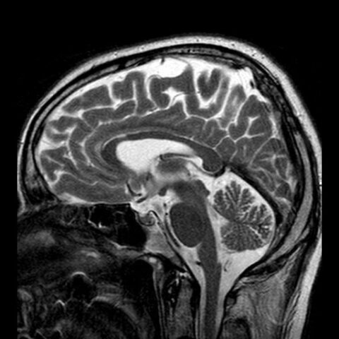 Magnetresonanz-Tomografie (MRT) - Radiologie Baunatal-Kassel
